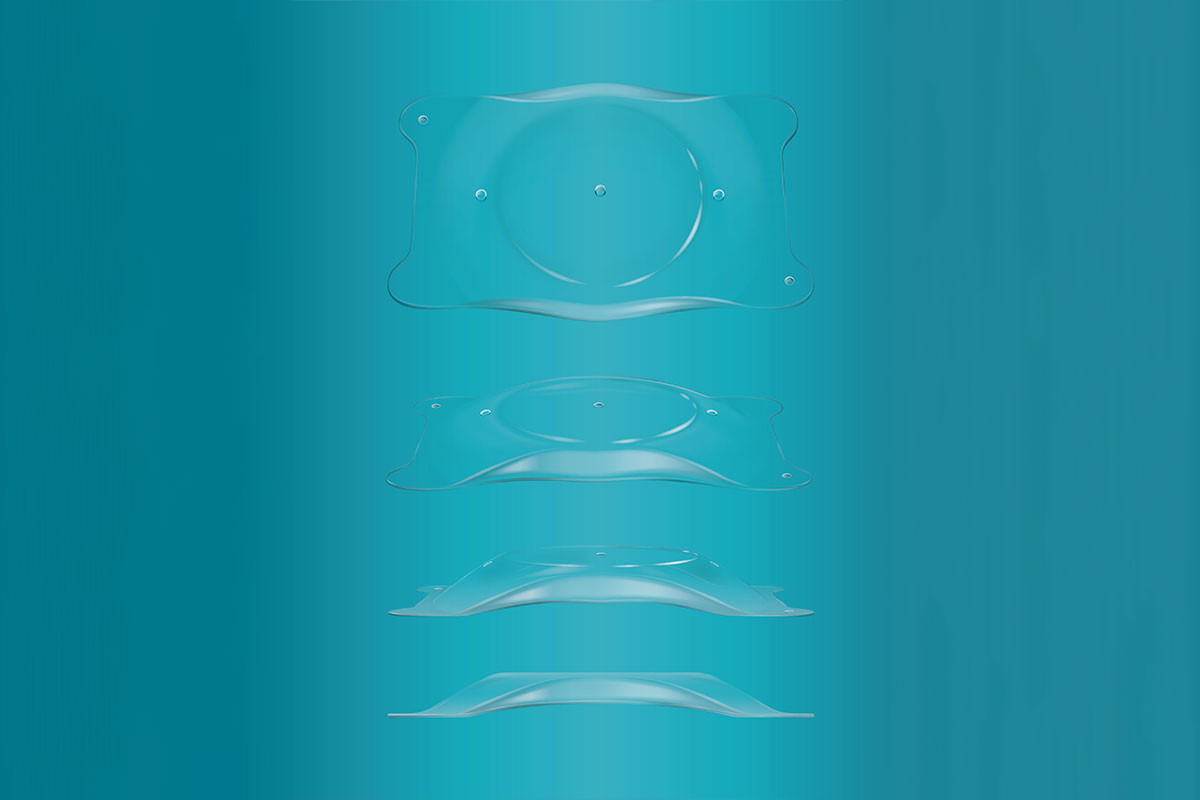 EVO ICL in Bend, OR | OnSight Eye Center